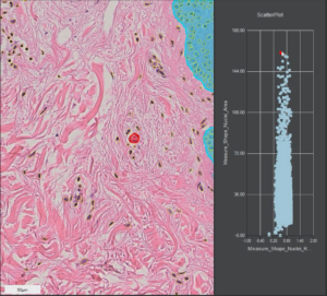 Histology quantification software with AI - HistoMetriX